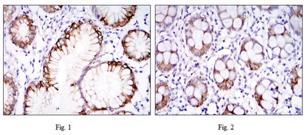 Anti-CA9 Antibody, clone 2D3 | MABN713